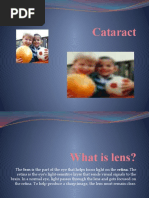 Ncp Cataract
