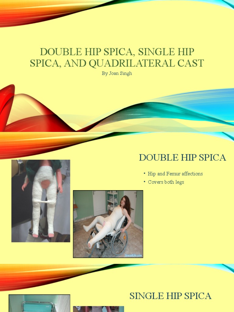 Double Hip Spica, Single Hip Spica, and Quadrilateral Cast | PDF
