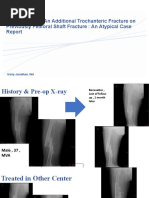 PTTI: Adult Flatfoot Insights | PDF | Foot | Ankle