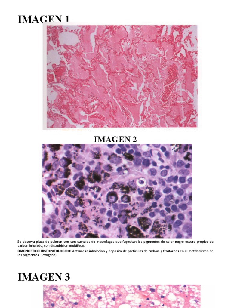 Taller de Lesiones Microscópicas | PDF