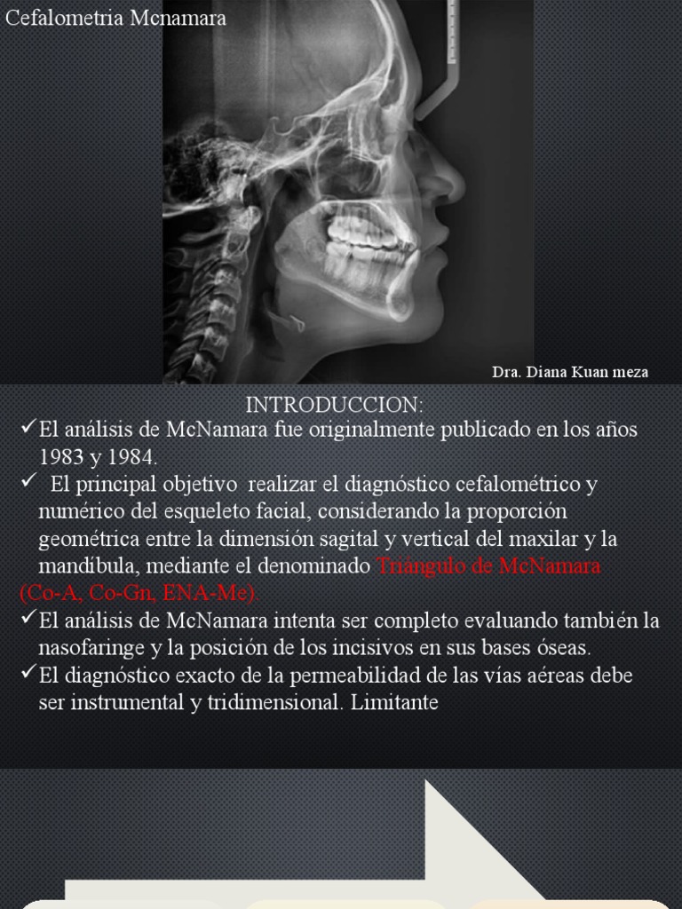 Cefalometria MCNAMARA | PDF | Longitud | Anatomía de los primates