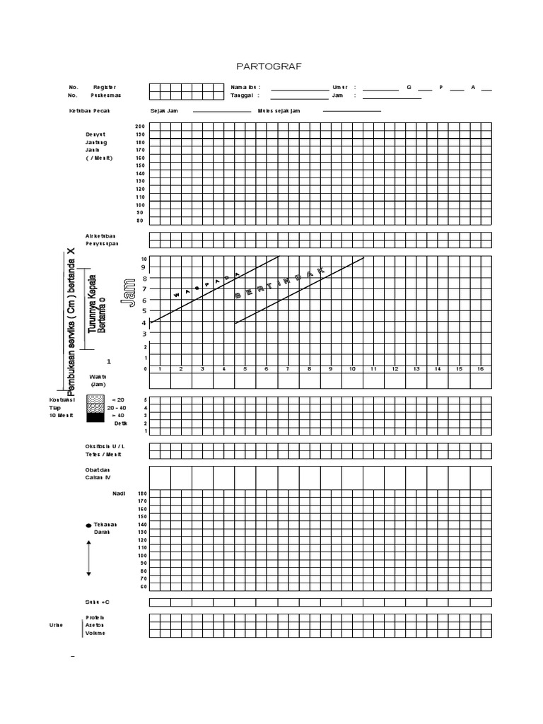 Contoh Pengisian Partograf Persalinan | PDF