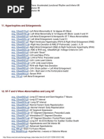 Right Ventricular Hypertrophy (RVH) - LITFL - ECG Library Diagnosis ...