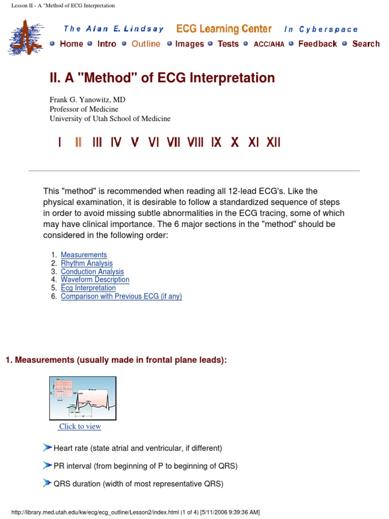 II. A "Method" of ECG Interpretation: Frank G. Yanowitz, MD Professor ...