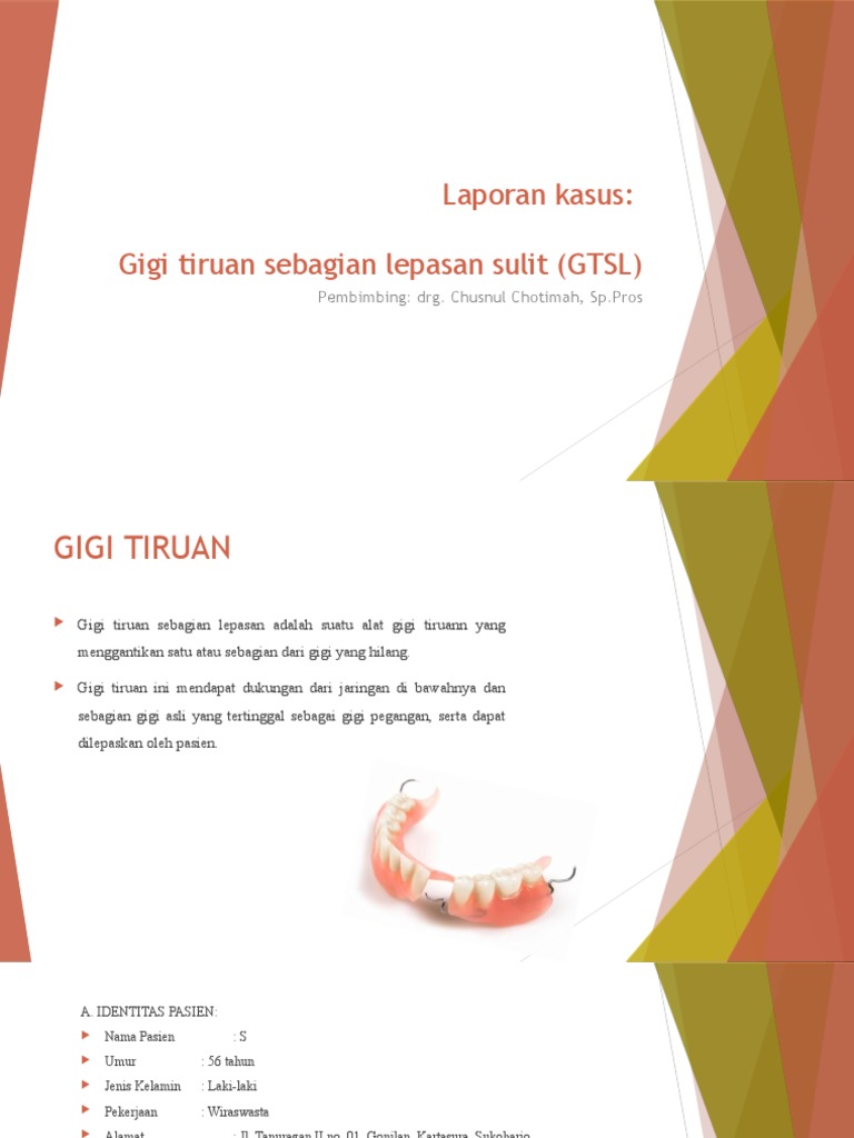 GTSL | PDF