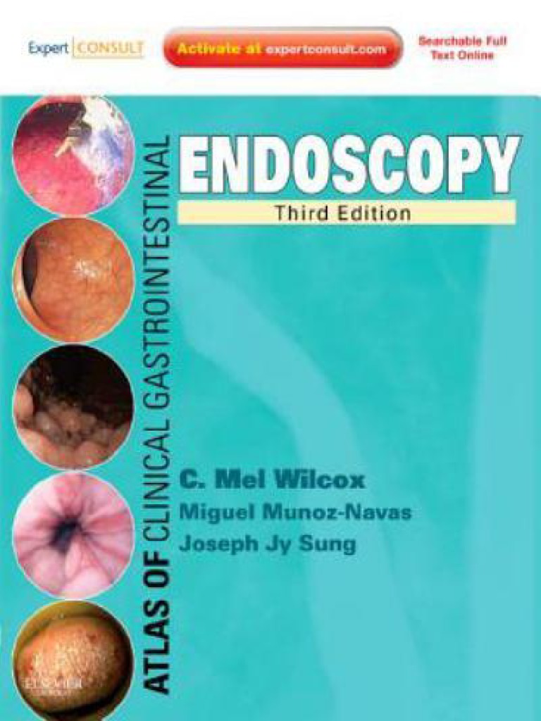 Atlas of Clinical GI Endoscopy 2012 PDF | Download Free PDF | Esophagus ...