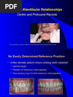 Prosthodontic Diagnostic Index (Pdi) For The Partially Edentulous and ...