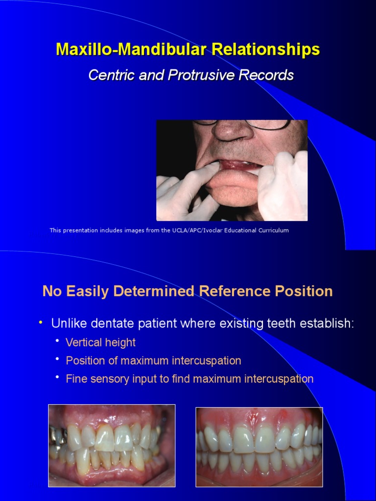 Centric & Protrusive Record | PDF | Mouth | Dentistry