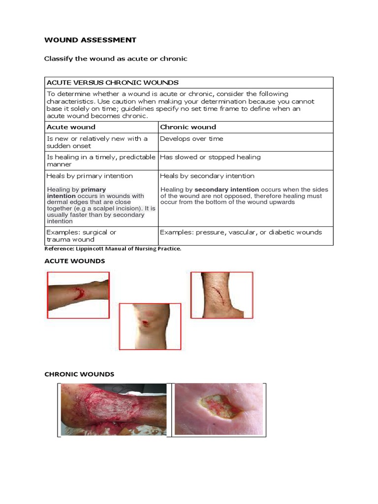 Classifying Acute Chronic Wound | PDF | Self-Improvement | Wellness