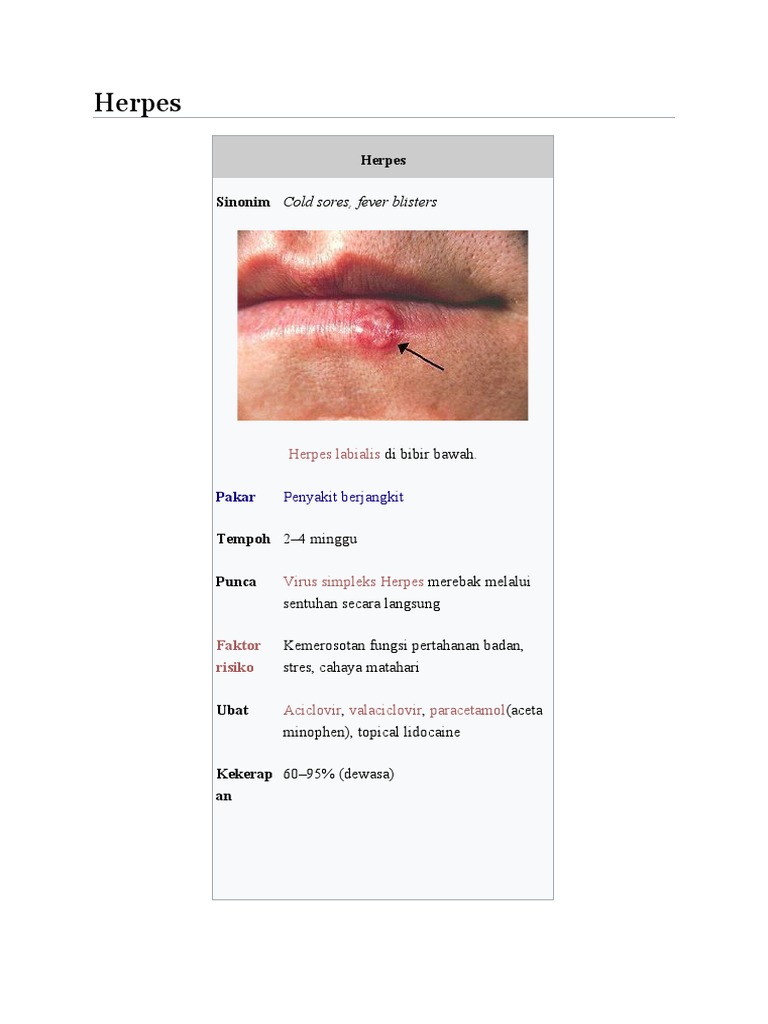 Penyakit Herpes | PDF | Pengembangan Diri