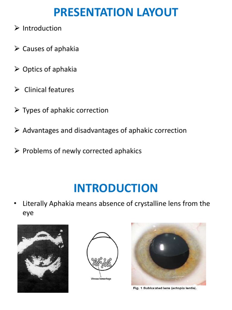 Aphakia Vs Contact Lens | PDF | Contact Lens | Eye