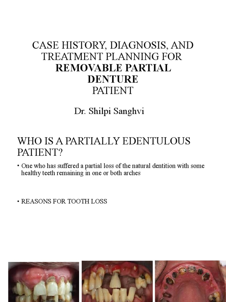 RPD Patient Case History and Treatment Plan | PDF | Dental Implant ...