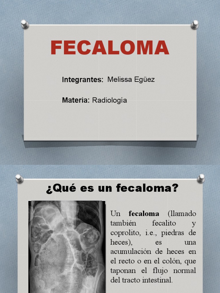 Fecaloma | PDF | Salud y bienestar