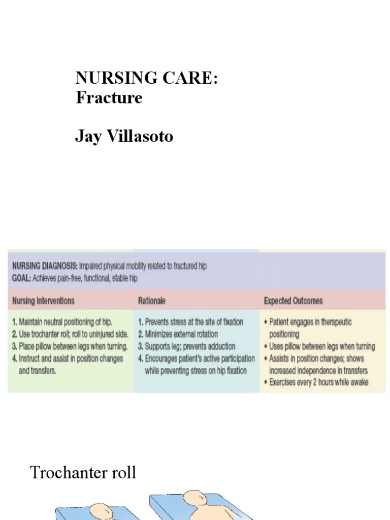 Nursing Care Considerations for Patients with Fractures: A Focus on ...
