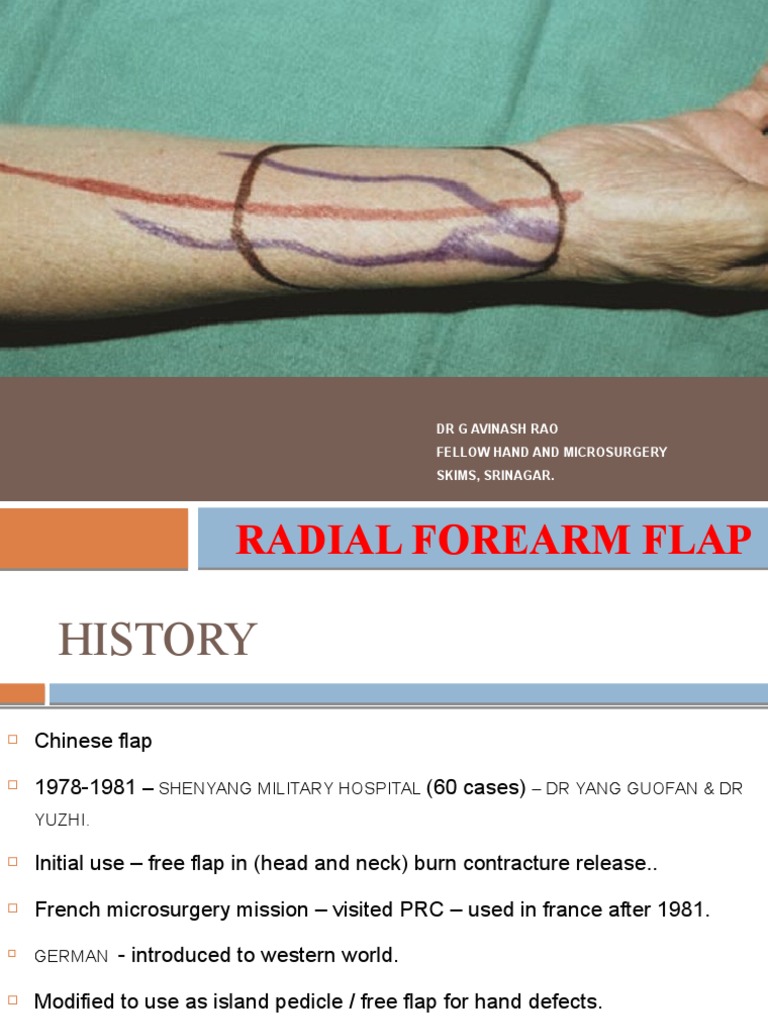 Radial Forearm Flap: DR G Avinash Rao Fellow Hand and Microsurgery ...