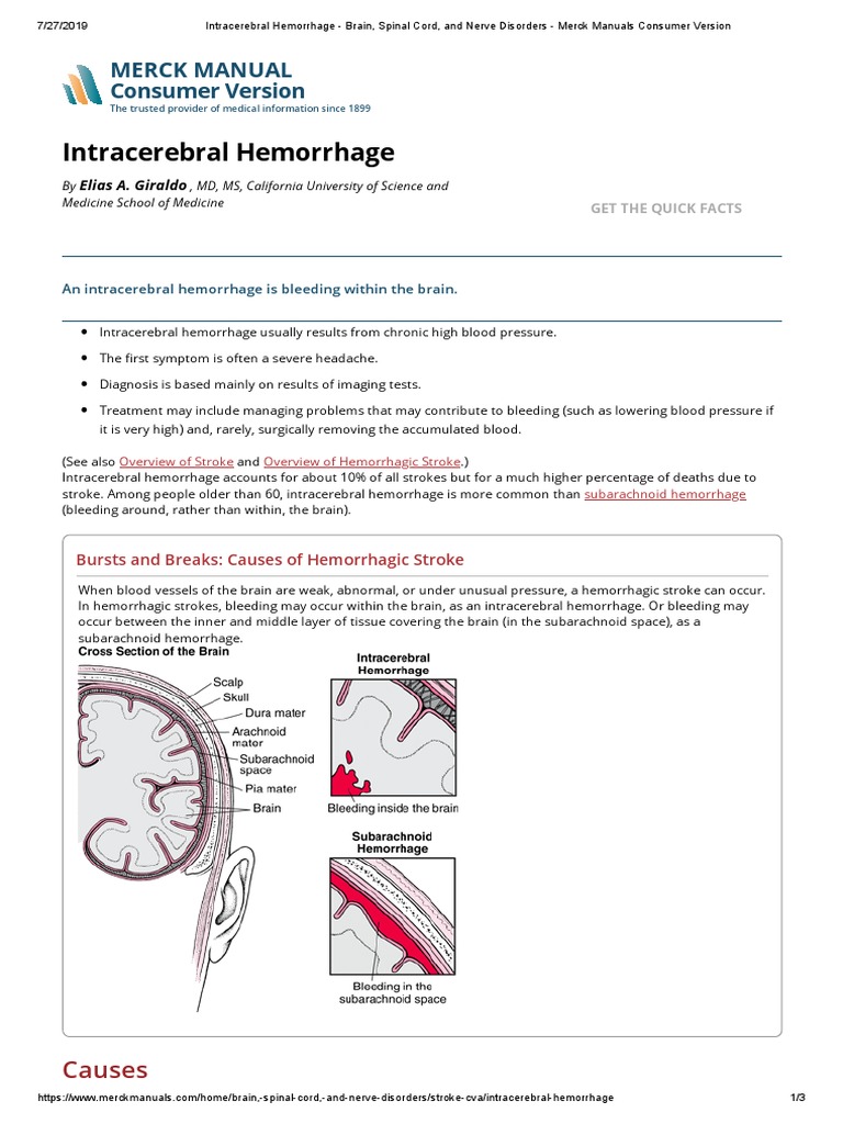 Intracerebral Hemorrhage: Merck Manual Consumer Version | PDF | Stroke ...