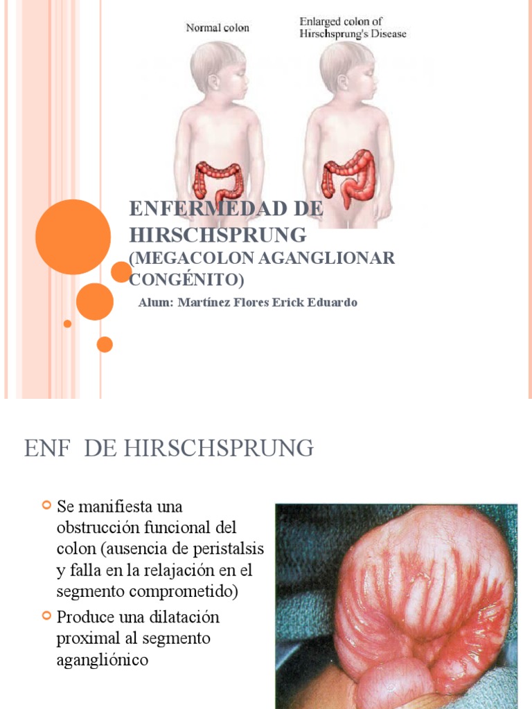 4 Megacolon | PDF | Enfermedad de Crohn | Biología