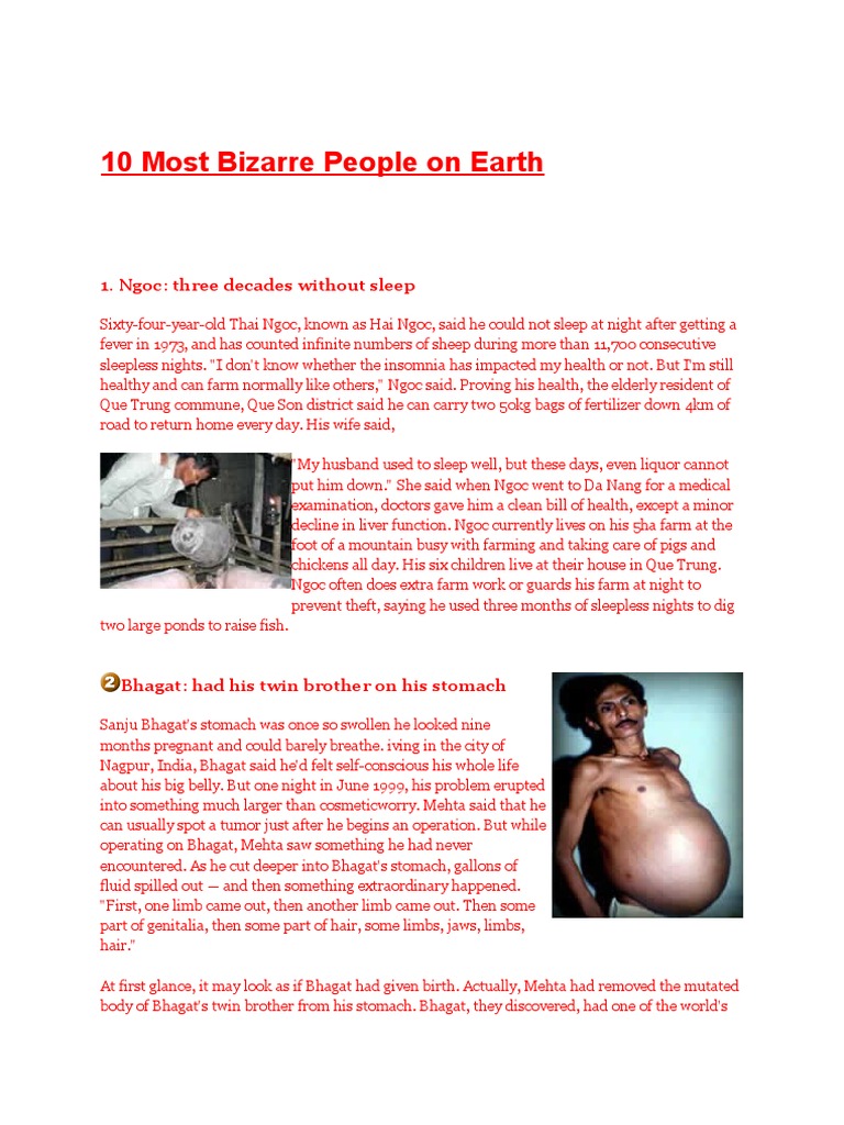10 Most Bizarre People On Earth: 1. Ngoc: Three Decades Without Sleep | PDF