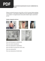 Usos de Chasis en Radiografía | PDF