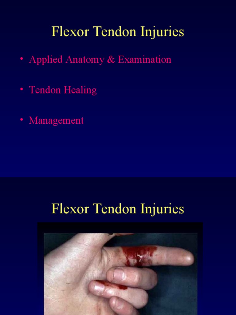 Flexor Tendon Injuries: - Applied Anatomy & Examination - Tendon ...
