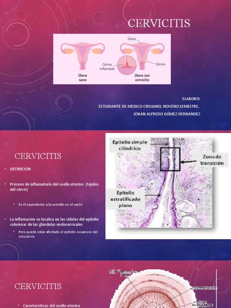 Cervicitis Ginecologia Practica | PDF | Inflamación | Anatomia sexual