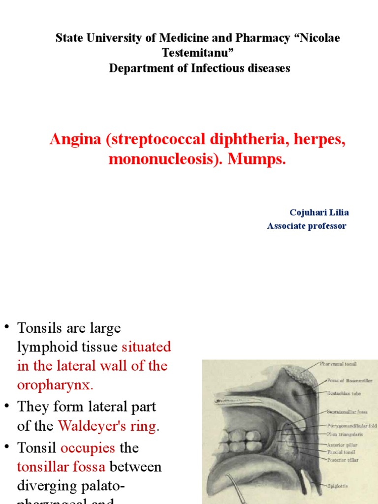 Angina (Streptococcal Diphtheria, Herpes, Mononucleosis) - Mumps ...