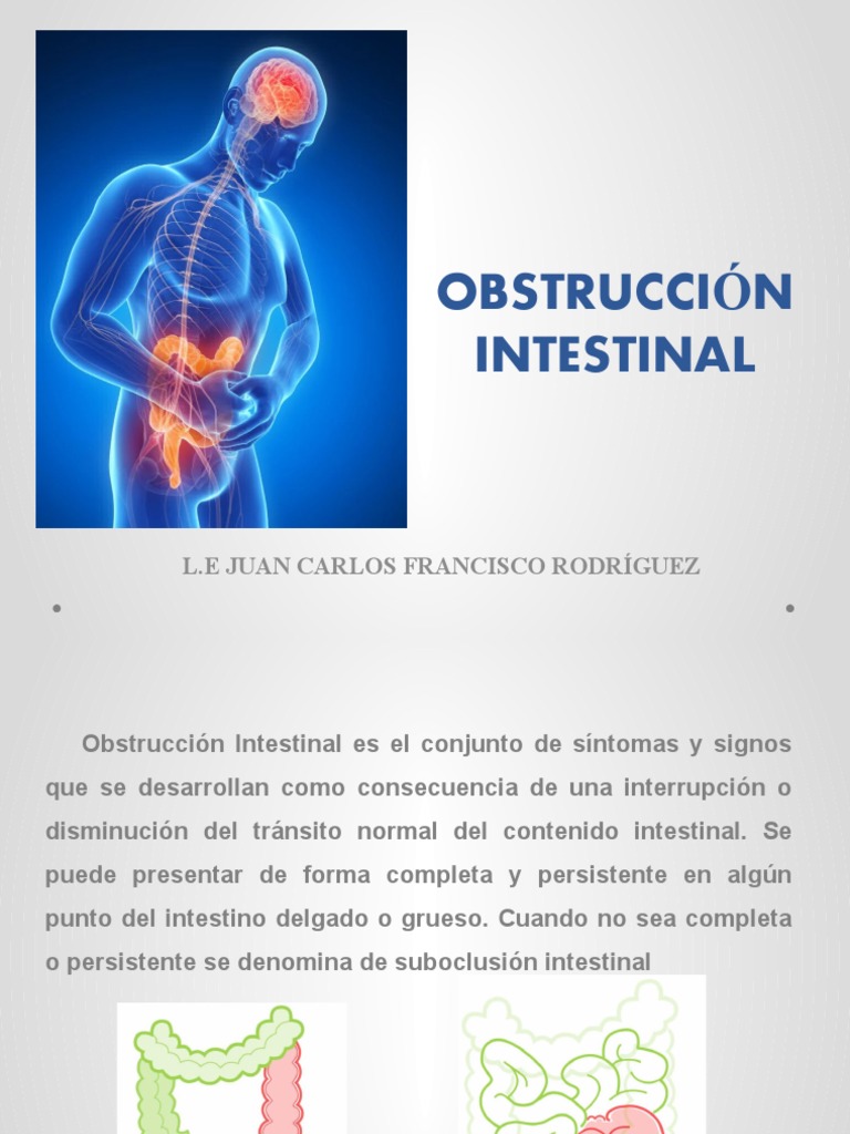 Obstrucción Intestinal: Causas y Tratamiento | PDF | Rtt | Ciencias de ...