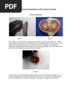 Types of Necrosis and Infarct | PDF | Necrosis | Ischemia