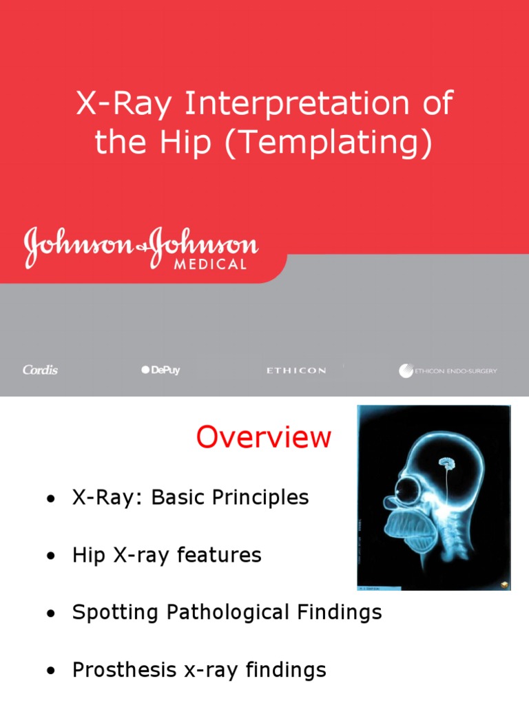 X-Ray Interpretation of The Hip | PDF | Hip | Pelvis