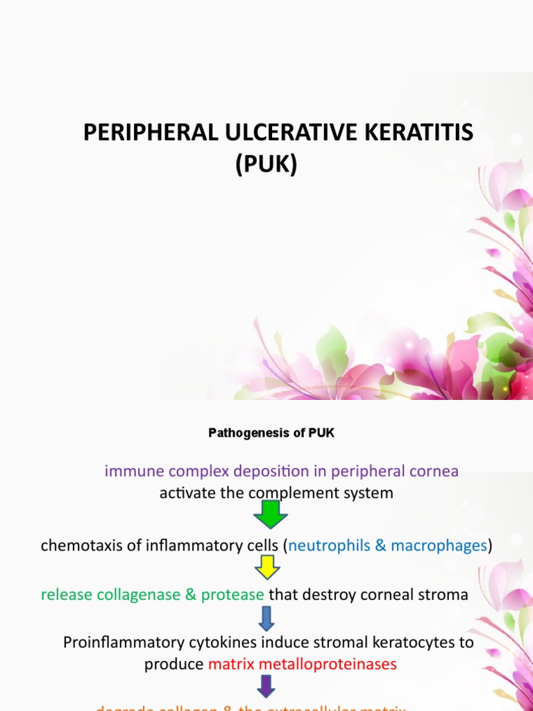 PUK Vs Mooren Ulcer Presentasi Final | PDF | Cornea | Immunology