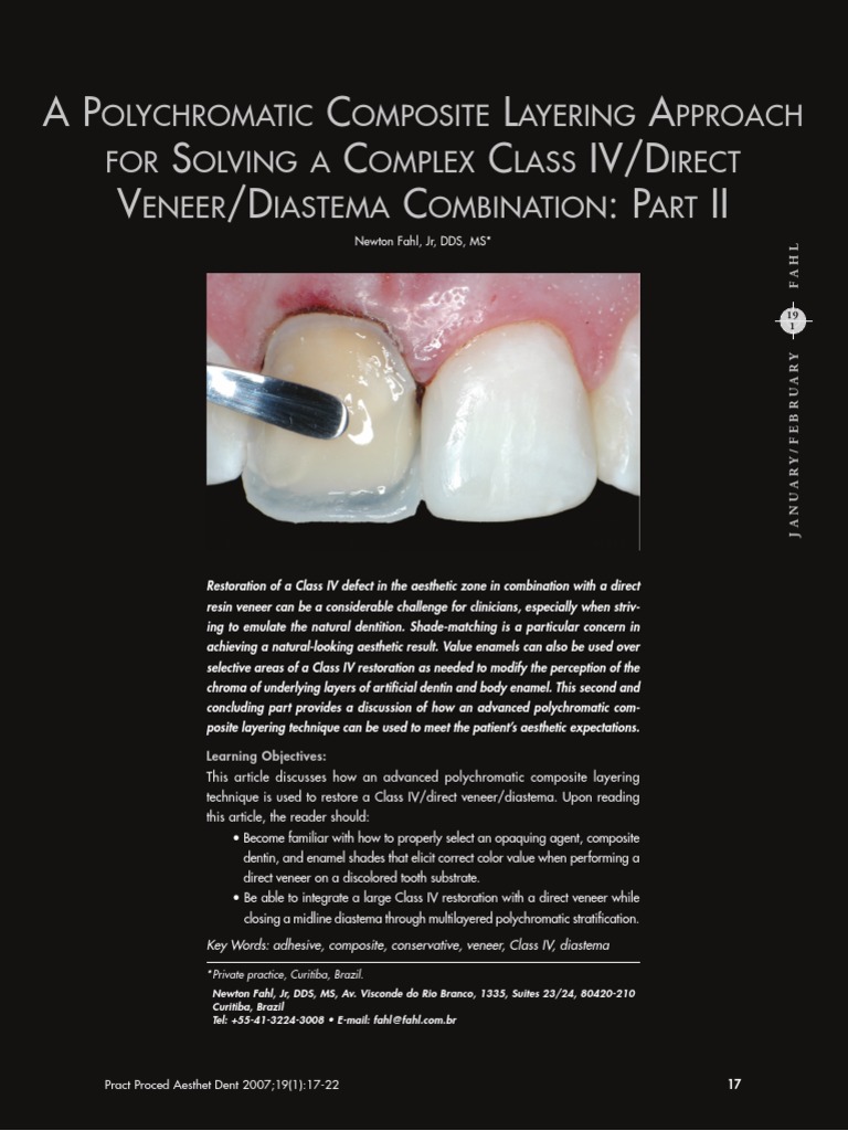 class IV restorations polychromatic | Tooth Enamel | Dental Composite