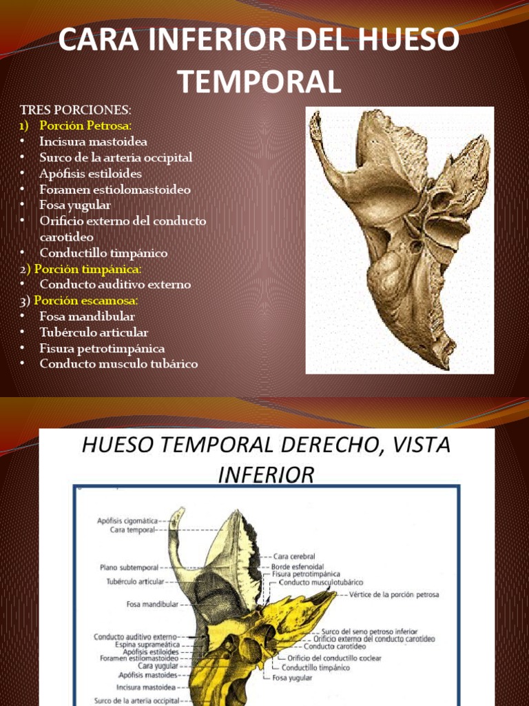 HUESO TEMPORAL Cara Inferior | PDF