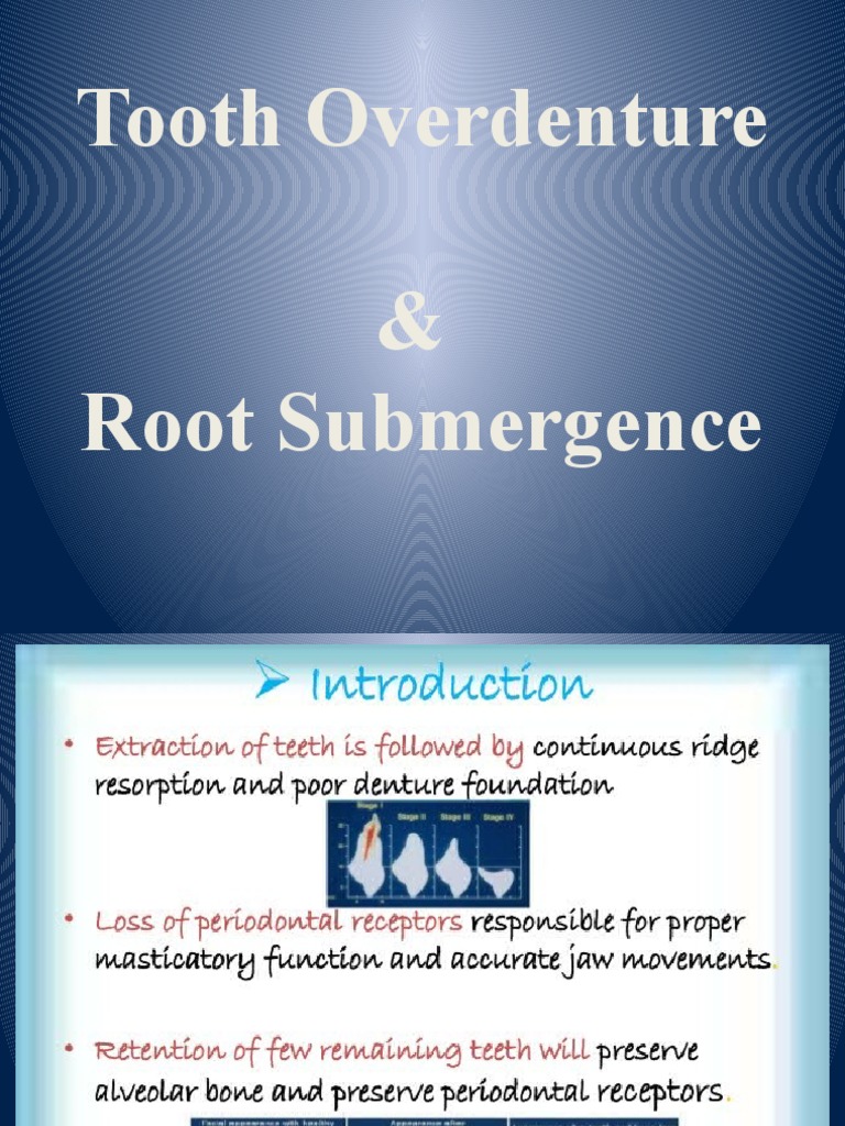 Toot Overdenture Root Submergence | PDF