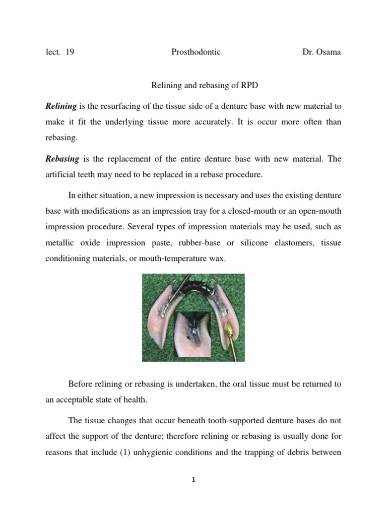 Relining and Rebasing | PDF | Dentures | Mouth