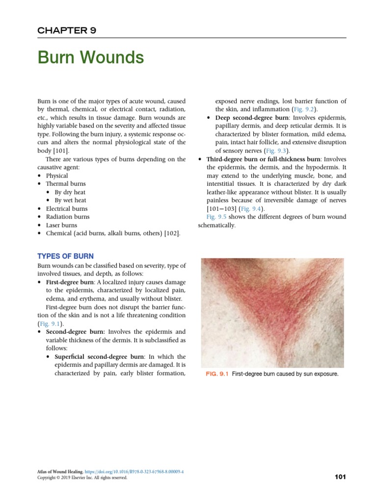 Burn Wounds | PDF | Burn | Wound