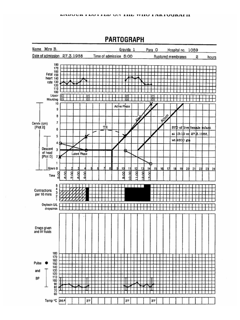 WHO Partograph Example | PDF | Public Health | Human Reproduction