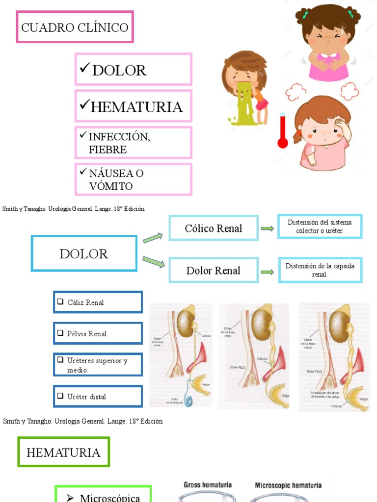 Cuadro Clínico Litiasis | PDF