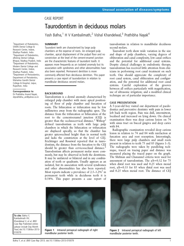Kunta Ar Soram J530205010 Taurodonsia | PDF | Dental Anatomy | Human Tooth