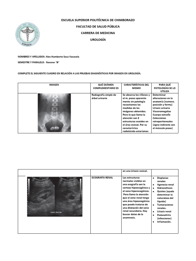 Practica Exámenes Complementarios Urología | PDF | Riñón | Angiografía