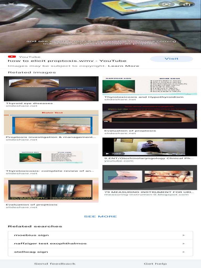 Naffziger Sign - Google Search | PDF | Computers