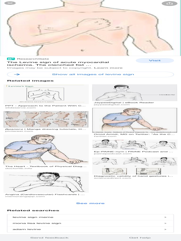 Levine Sign - Google Search | PDF | Ischemia | Cardiovascular System