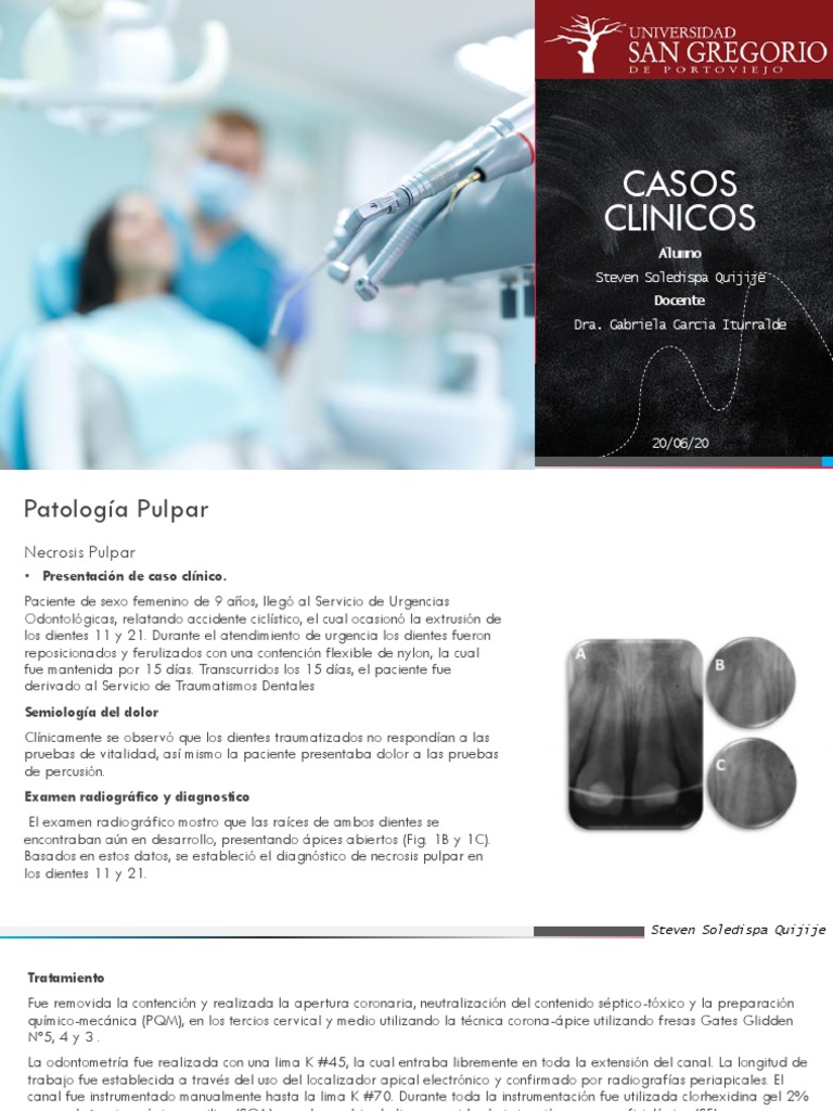 Necrosis Pulpar y Absceso Fénix: Casos Clínicos | PDF | Medicina ...