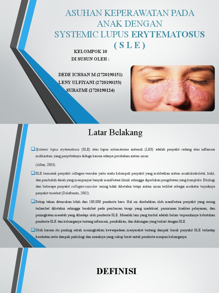 Asuhan Keperawatan Pada Anak Dengan Systemic Lupus Erytematosus | PDF ...