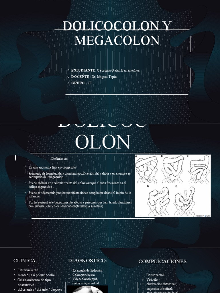 Dolicocolon y Megacolon | PDF | Estreñimiento | Enfermedades digestivas