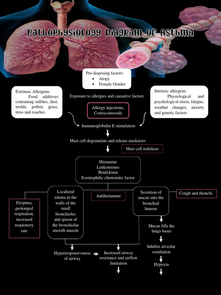 Pathophysiology Diagram of Asthma PDF | PDF | Respiratory System | Asthma