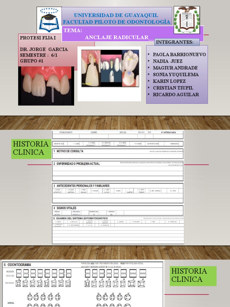 Procedimiento clínico para la colocación de postes intrarradiculares en ...