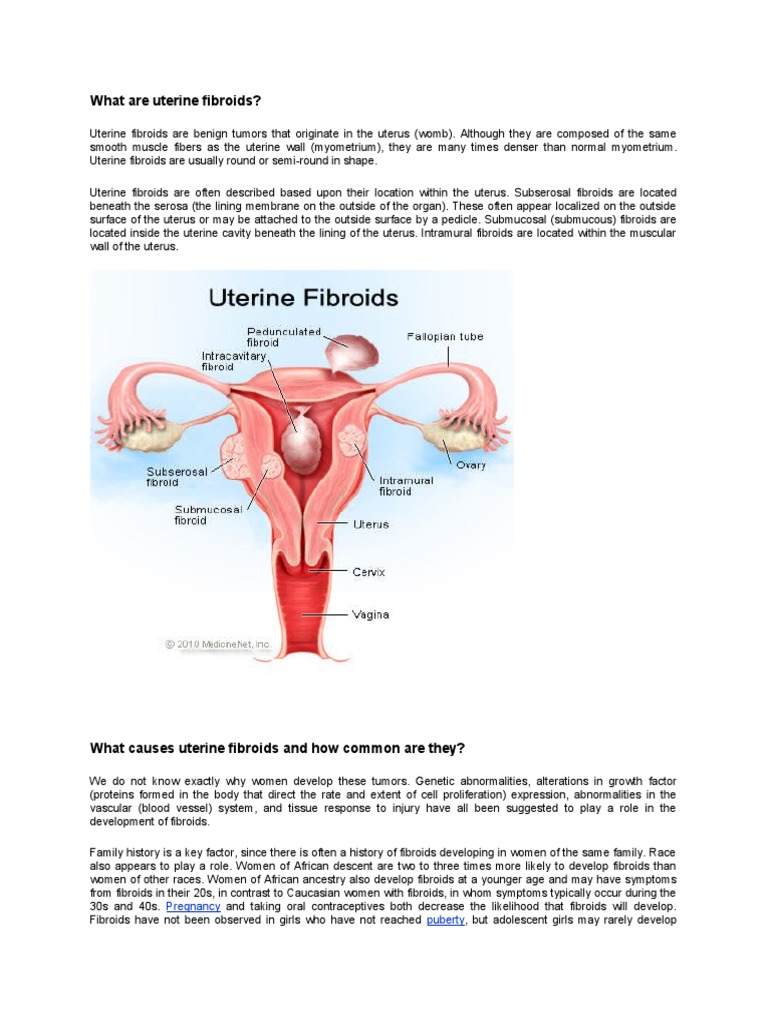 What Are Uterine Fibroids | Download Free PDF | Uterus | Menopause