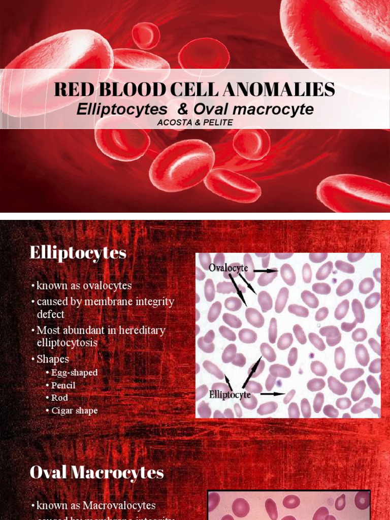 Red Blood Cell Anomalies: Elliptocytes & Oval Macrocyte | PDF