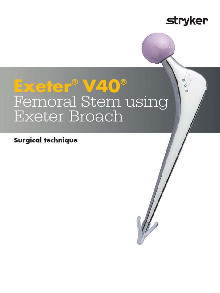 Exeter V40: Femoral Stem Using Exeter Broach | PDF | Surgery | Clinical ...