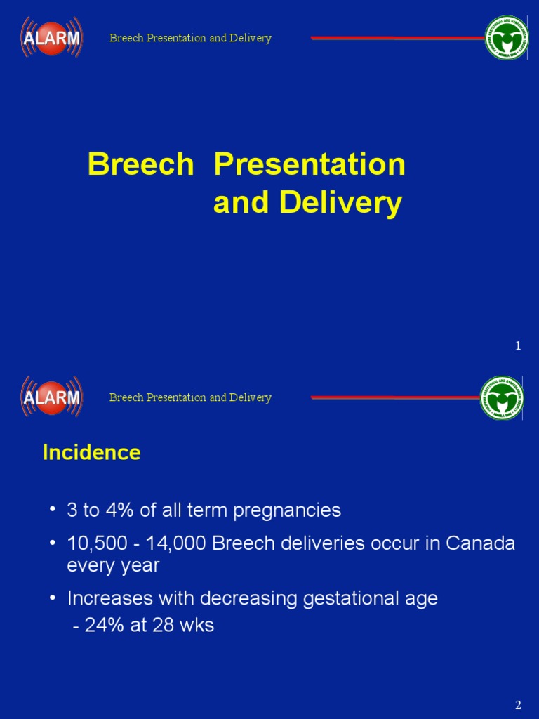 Breech Presentation and Delivery Alarm | PDF | Childbirth | Human ...